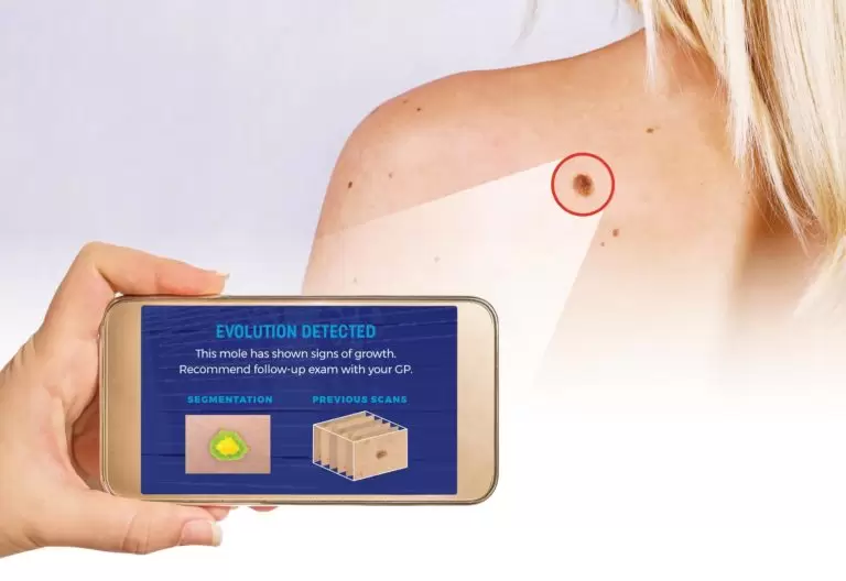 New technology could turn every smartphone into a skin cancer detector ...