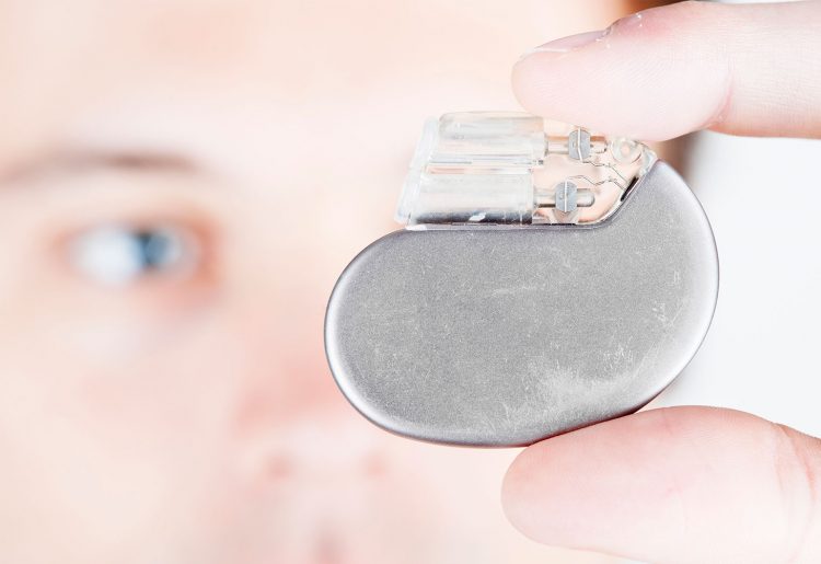 How a ‘humble tinkerer’ accidentally invented the pacemaker - create ...