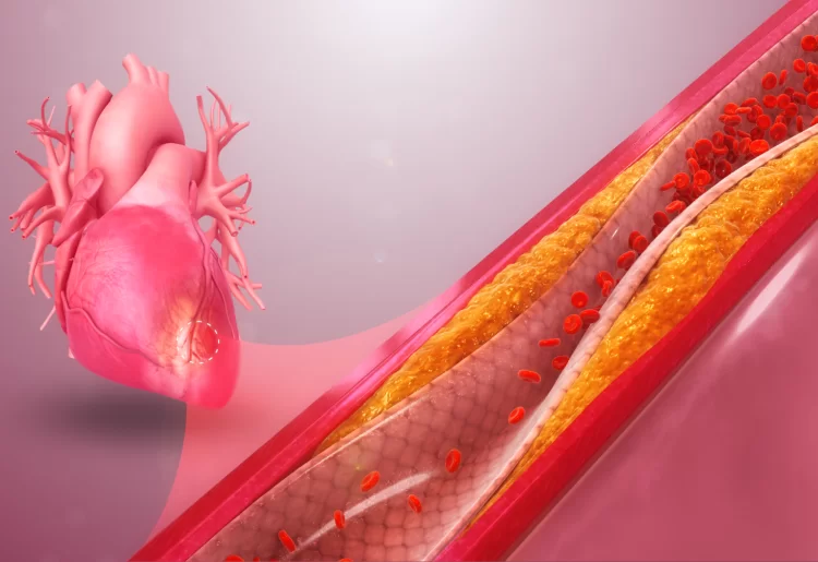 Could these tissue-engineered blood vessels help save lives during ...