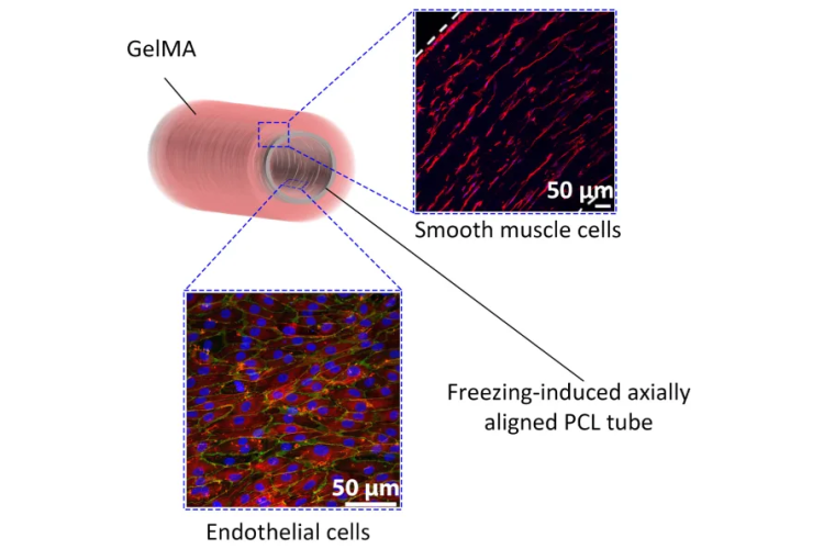 Could these tissue-engineered blood vessels help save lives during ...