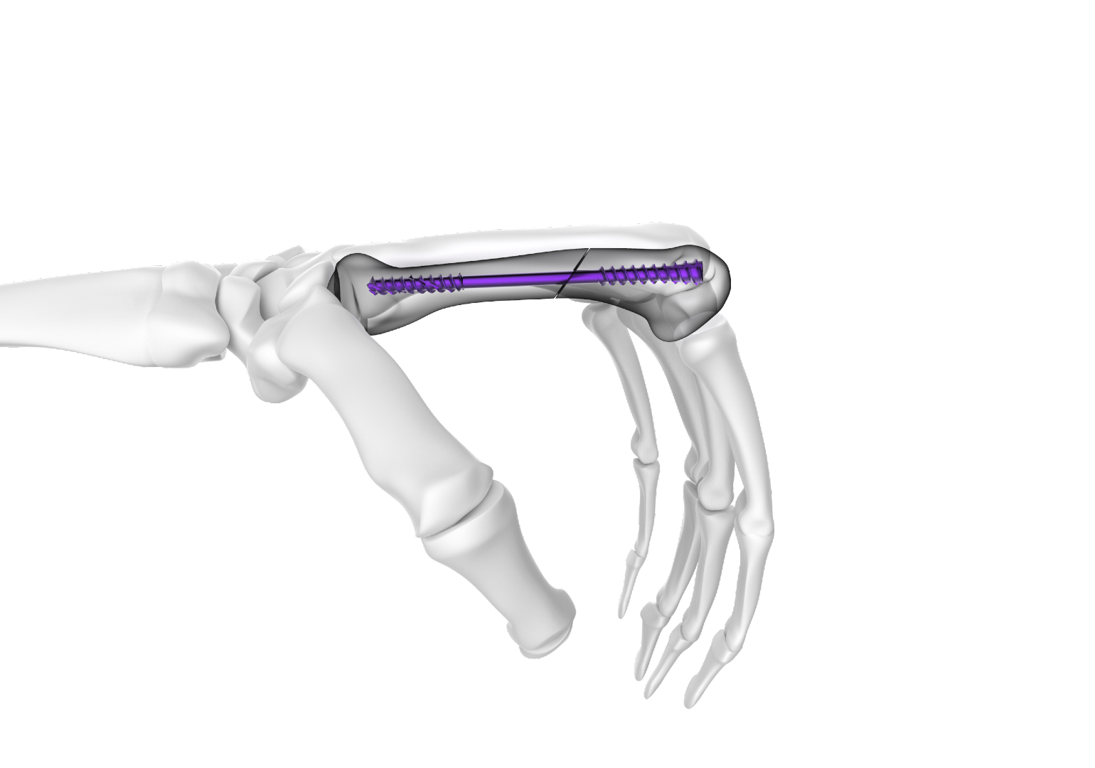 Nailing the sweet spot between engineering and medicine - create digital