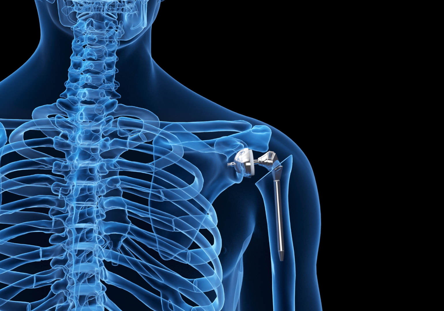 Why biomechanical engineers are vital to the future of public health ...